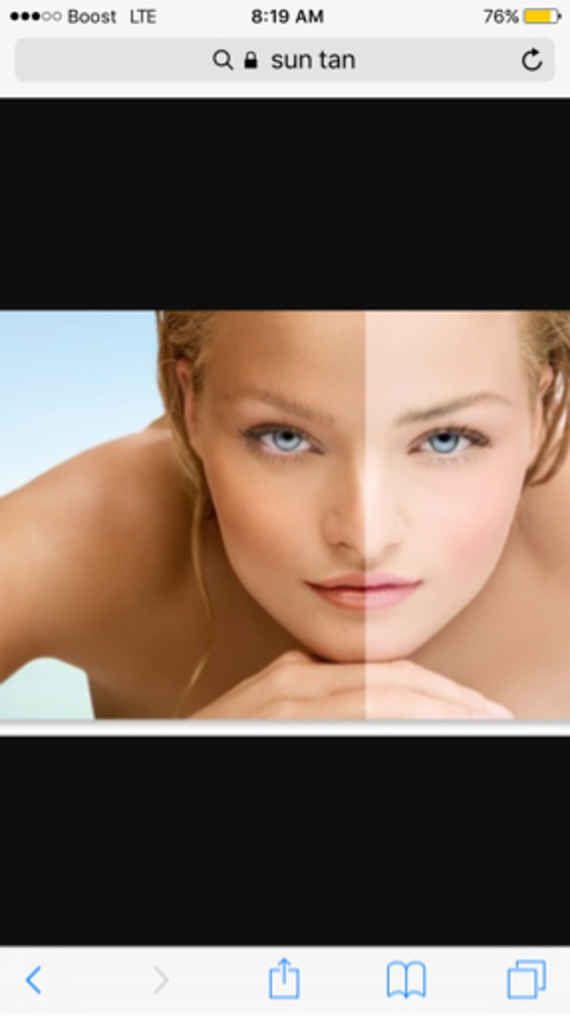 "suntan " 和 "sunburn " 和有什么不一样？ | HiNative