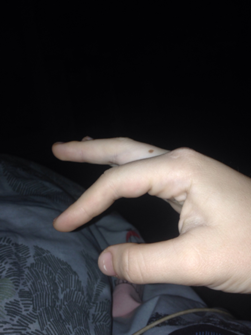 What is the meaning of "forehead flick"? - Question about English (UK) | HiNative