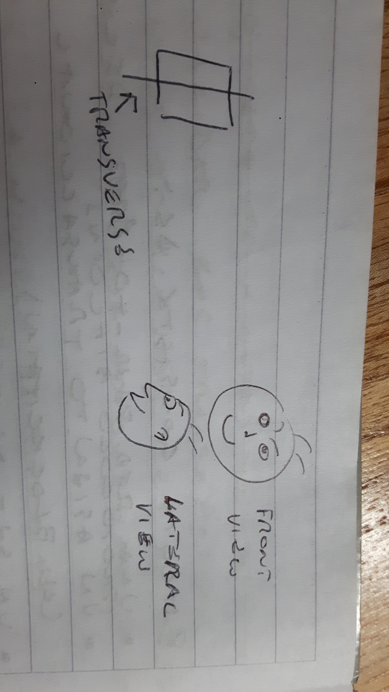 🆚What is the difference between "transverse" and "lateral ...