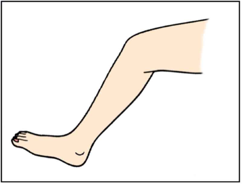 leg的卡通图片-千图网